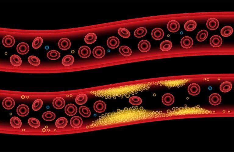 Štítek: sulodexid - PROFI Medicína